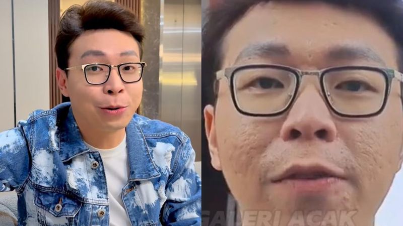 Dicibir Wajah Aslinya Terlihat Bopeng-bopeng, Dokter Richard Lee: Aku ...