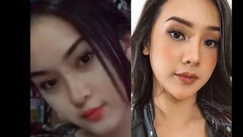 Heboh Foto Syur Mirip Anya Geraldine, Tanda Merah di Paha Jadi Sorotan - ERA.ID